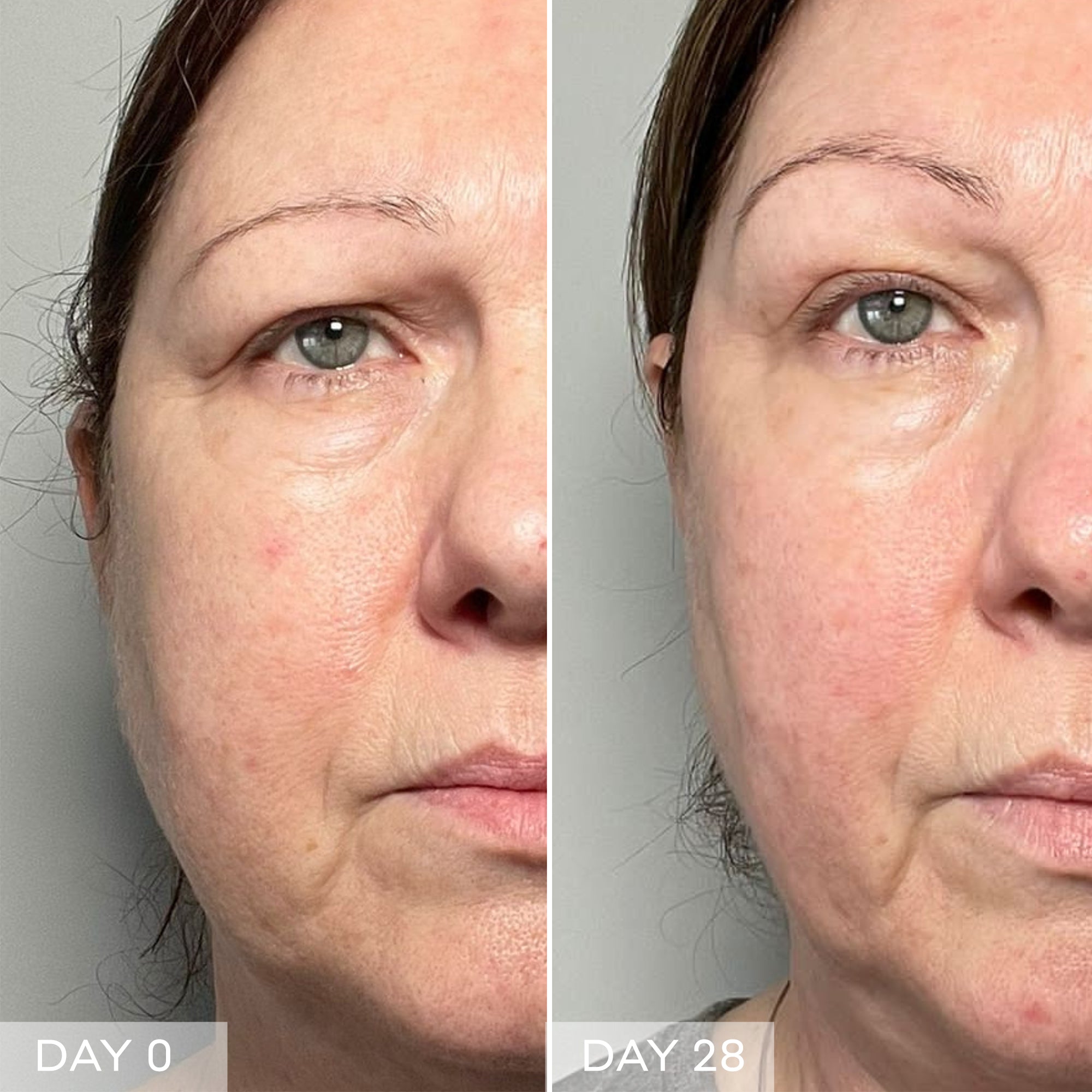 MAGNITONE FaceRocket® 5-in-1 Facial Firming + Toning Device