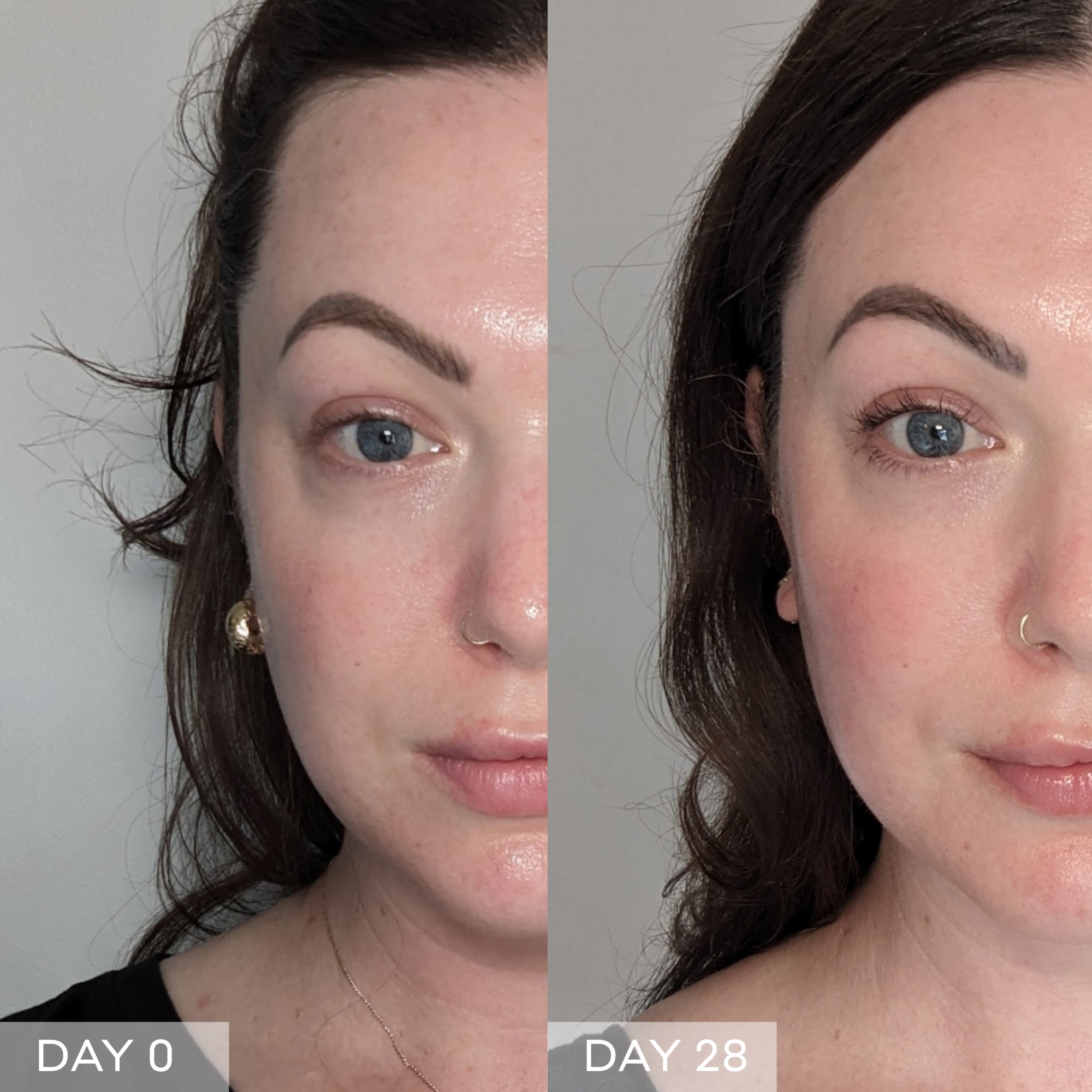 MAGNITONE FaceRocket® 5-in-1 Facial Firming + Toning Device