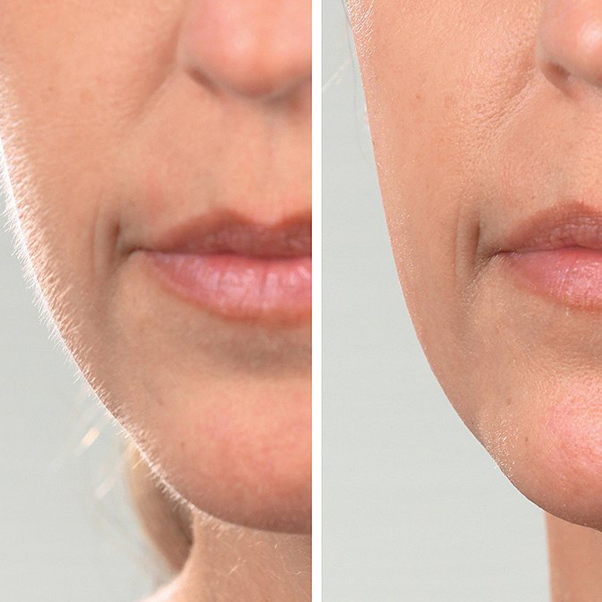 DermaQueen Vibra-Sonic® Hair Removal + Dermaplane Exfoliator – MAGNITONE